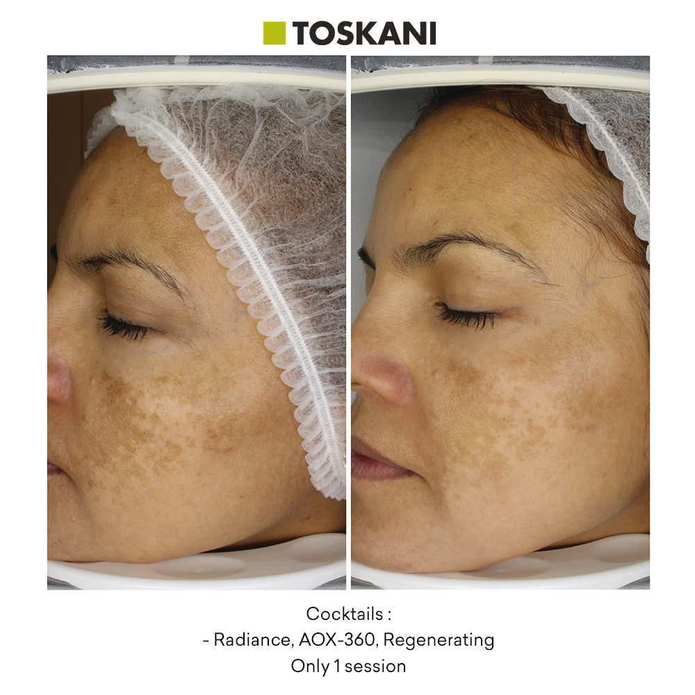 Toskani Regenerating Cocktail - BEAUTY D - Beauty Distribution