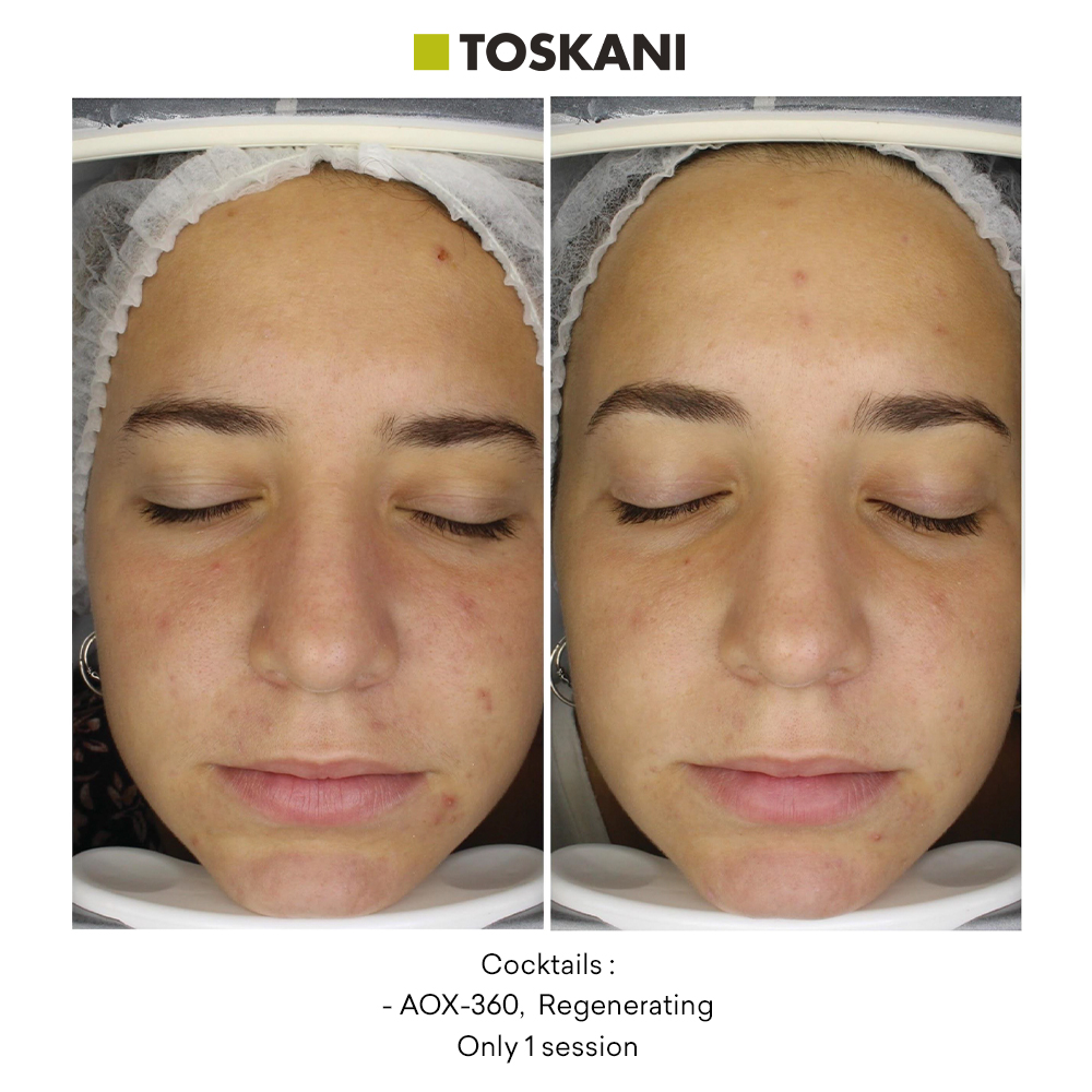 Toskani Regenerating Cocktail - BEAUTY D - Beauty Distribution